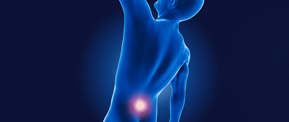 Annular Fissure - Low Back Pain Series - Mediphany
